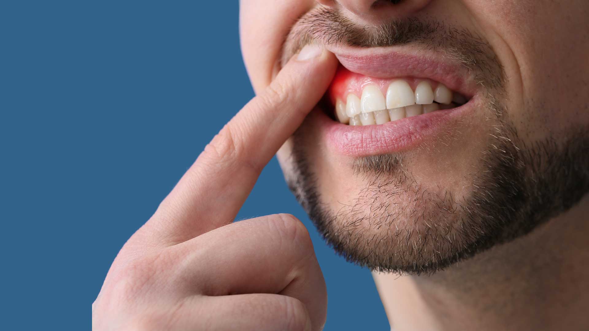 Je tandvlees gezond houden - Tandprothetiek Brabant