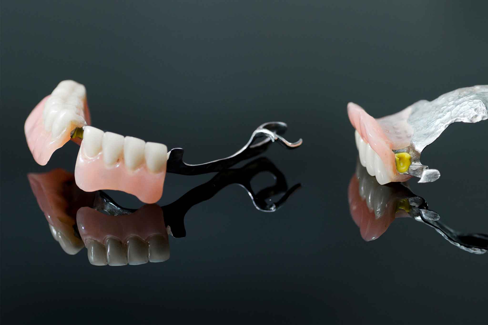 Blog: Wat is een Frameprothese en wat zijn de voordelen?